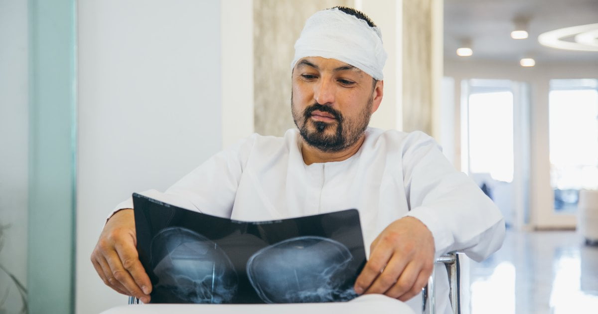 Head Injuries From Slip and Fall Accidents in Cleveland, Ohio